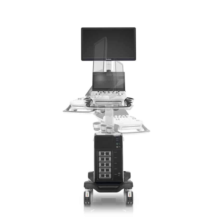 SonoScape P25 Elite | Enraf-Nonius